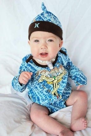 “Our Experience with Jayson Dallas Elwood” - Parenting Special Needs ...