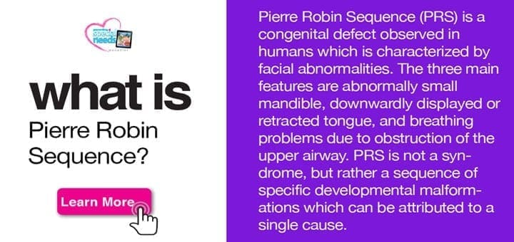 What is Pierre Robin Sequence? - Parenting Special Needs Magazine